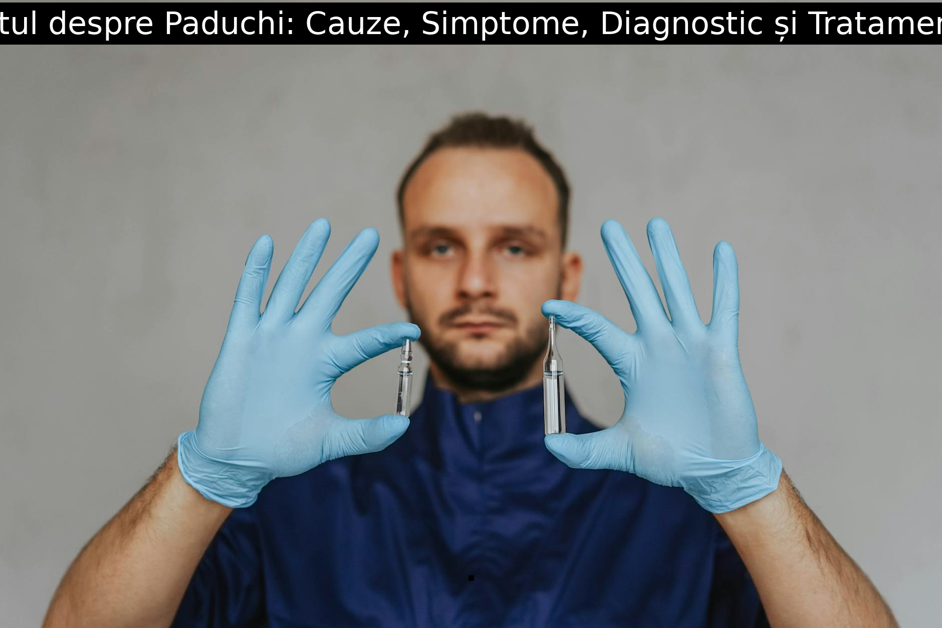 Totul despre Paduchi: Cauze, Simptome, Diagnostic și Tratament ...